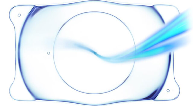 近視矯正手術（ICL手術）｜登戸駅徒歩1分の眼科【川崎・多摩アイクリニック】土曜診療、日帰り手術対応